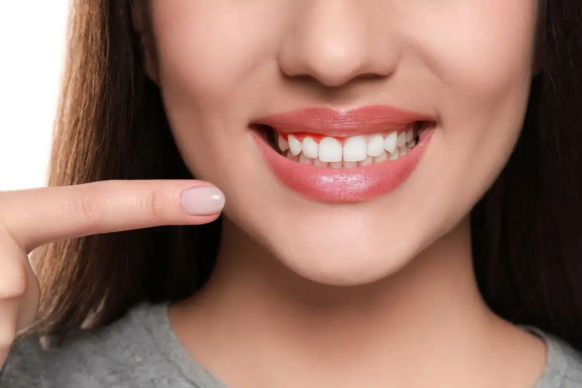 Tips to Maintain Healthy Gums After Dental Implant