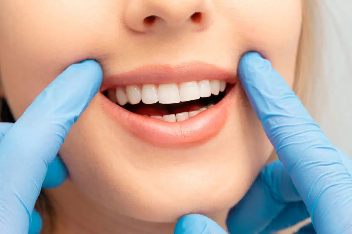 How to take good care of your teeth naturally. | Paradise Valley Dental