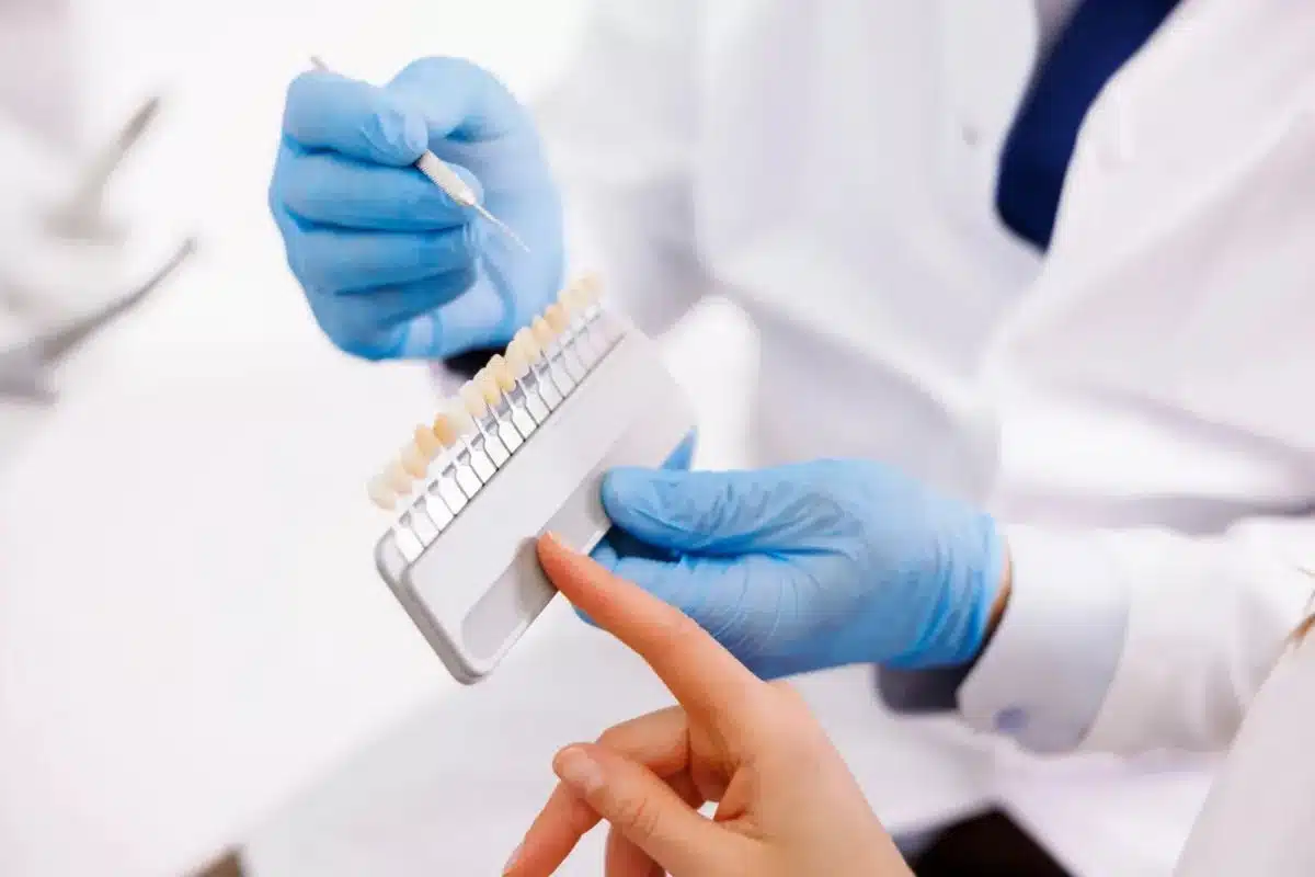 How to Clean & Care for Dental Veneers: Expert Tips